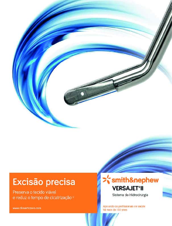 VERSAJET II | SMITH&NEPHEW | 3albe Produtos Hospitalares